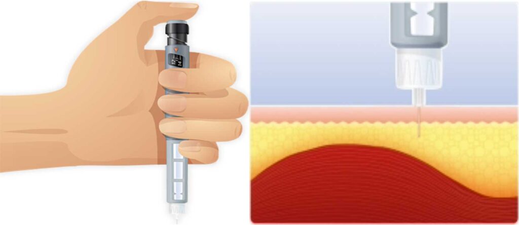 Hoe spuit je insuline - kidzenko.nl